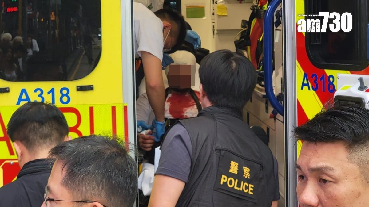 尖沙咀彌敦道男子遭二人持刀斬傷 頭破血流送院 | am730